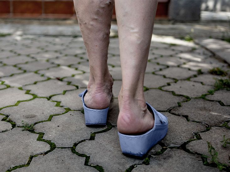 Dementia wandering: Signs, causes, and tips