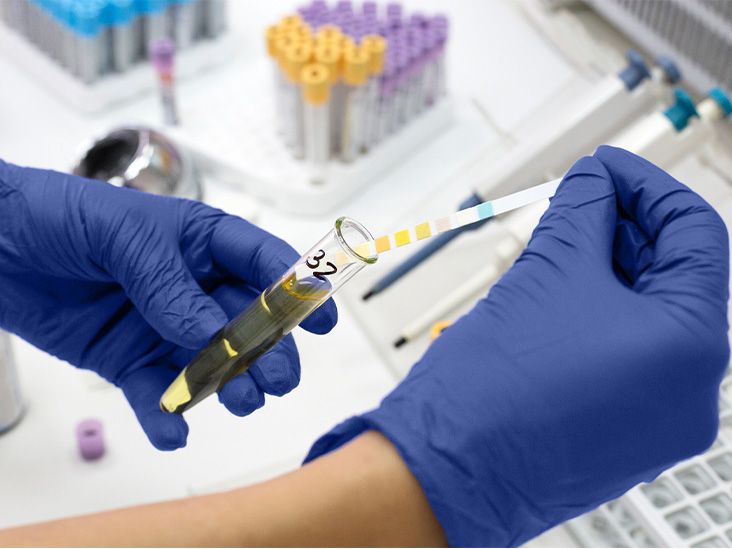 Understanding the stages of renal failure