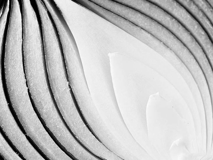 Balo disease: Symptoms, causes, treatment, and outlook