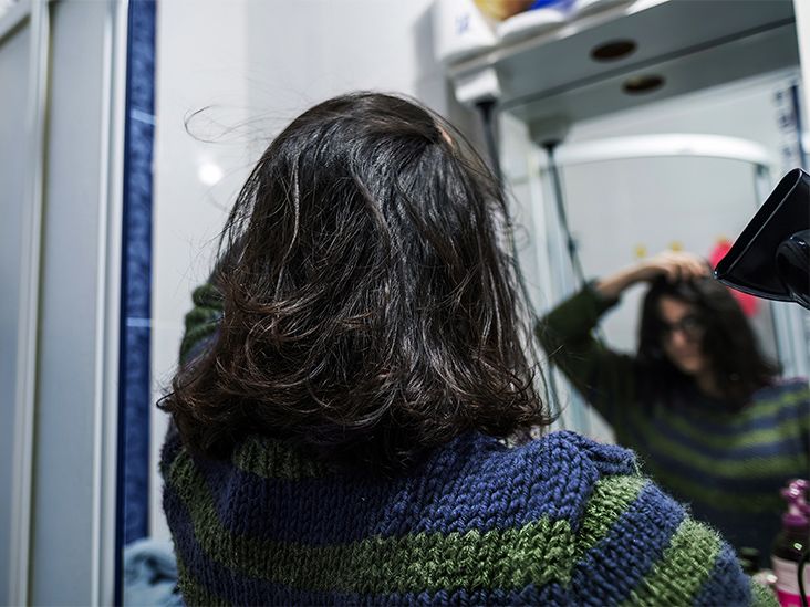 Scalp rosacea: Symptoms, management, and more