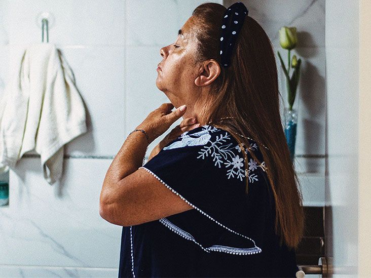 Turkey neck surgery: Procedure, preparation, and recovery