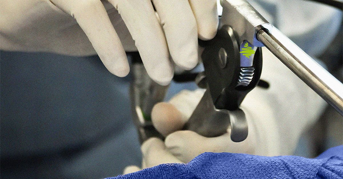 Types of vocal cord surgery: Cost, recovery, side effects