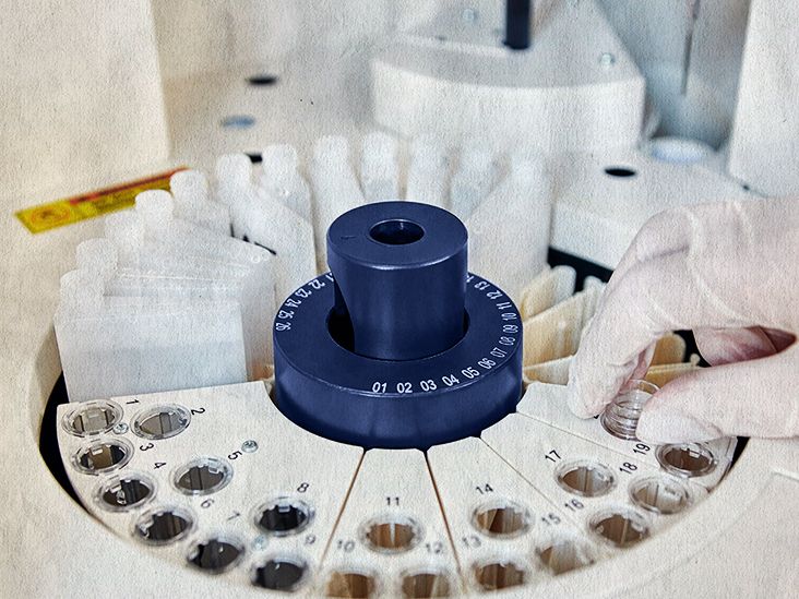 Alkaline phosphatase (ALP) level test: High and low levels