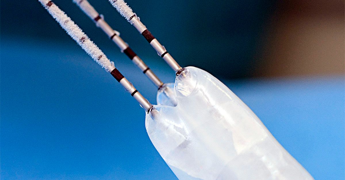 Cryoablation: Purpose and what to expect