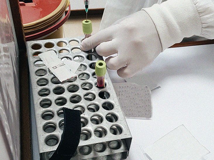 Mononucleosis skin rash: Symptoms, causes, and more