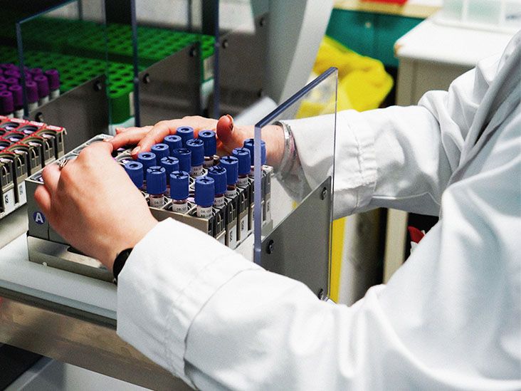 Normochromic anemia: Causes, diagnosis, and treatment