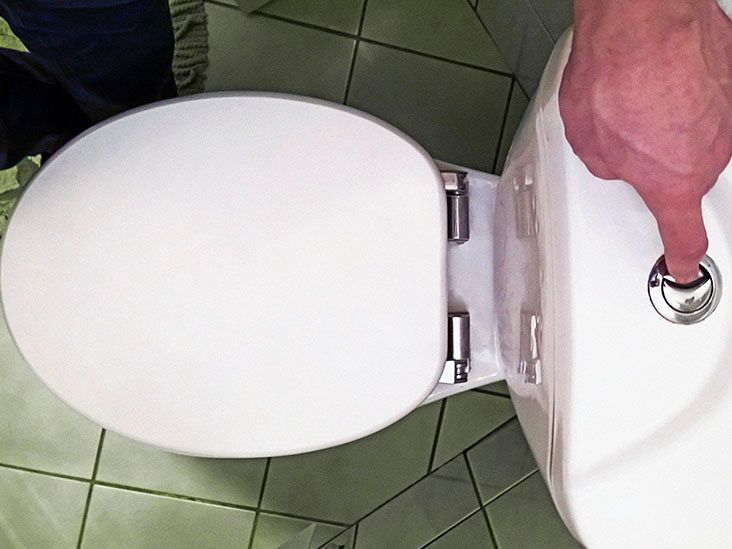 What color is urine with pancreatic cancer?