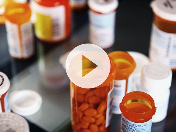 Severe arthritis: Prescription and alternative treatments for pain