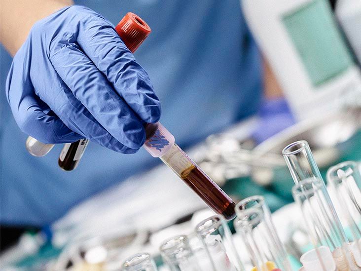 Primary vs. secondary hyperthyroidism: What to know