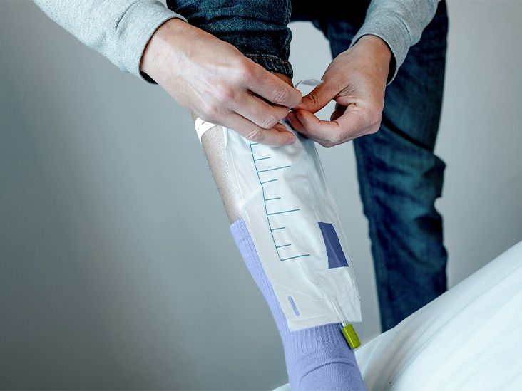 Self-catheterization for males: Purpose, types, and how to do it