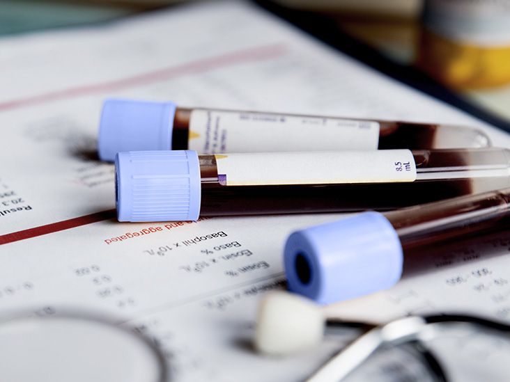 Total Iron Binding Capacity Tibc Test Results And What To Expect