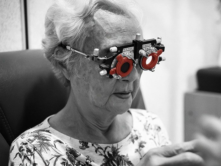 How fast does high myopic macular degeneration progress?