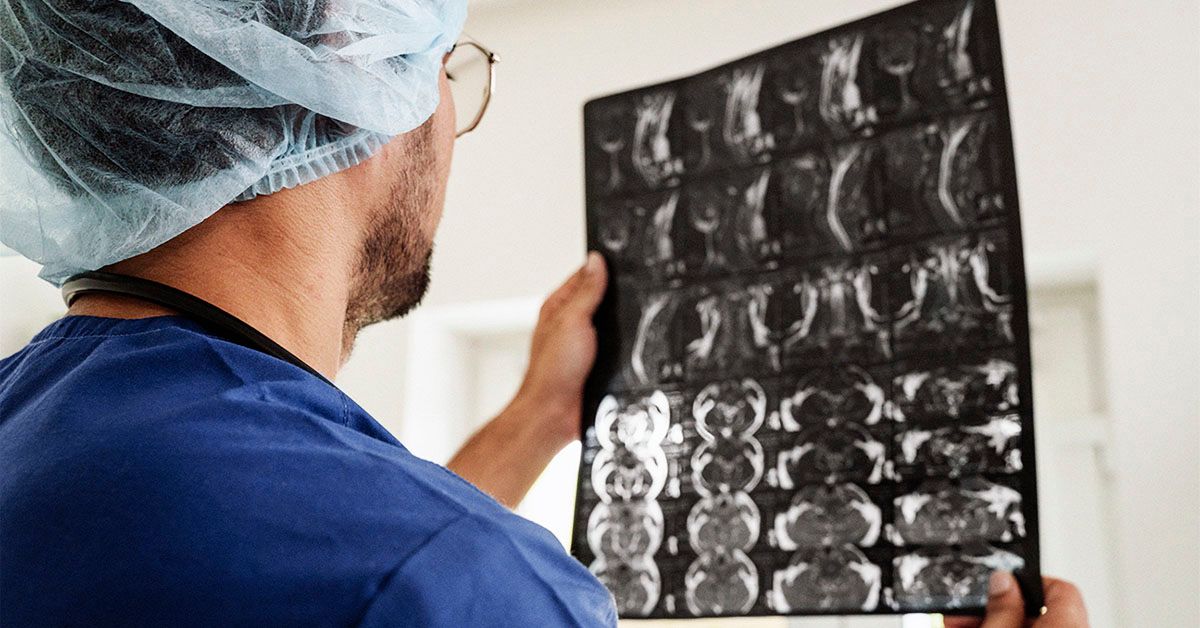 Ulcerative colitis progression guide