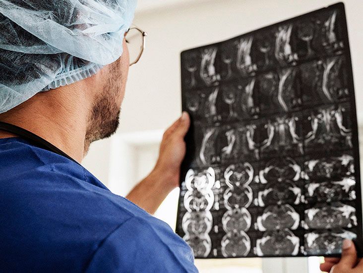 Ulcerative colitis progression guide