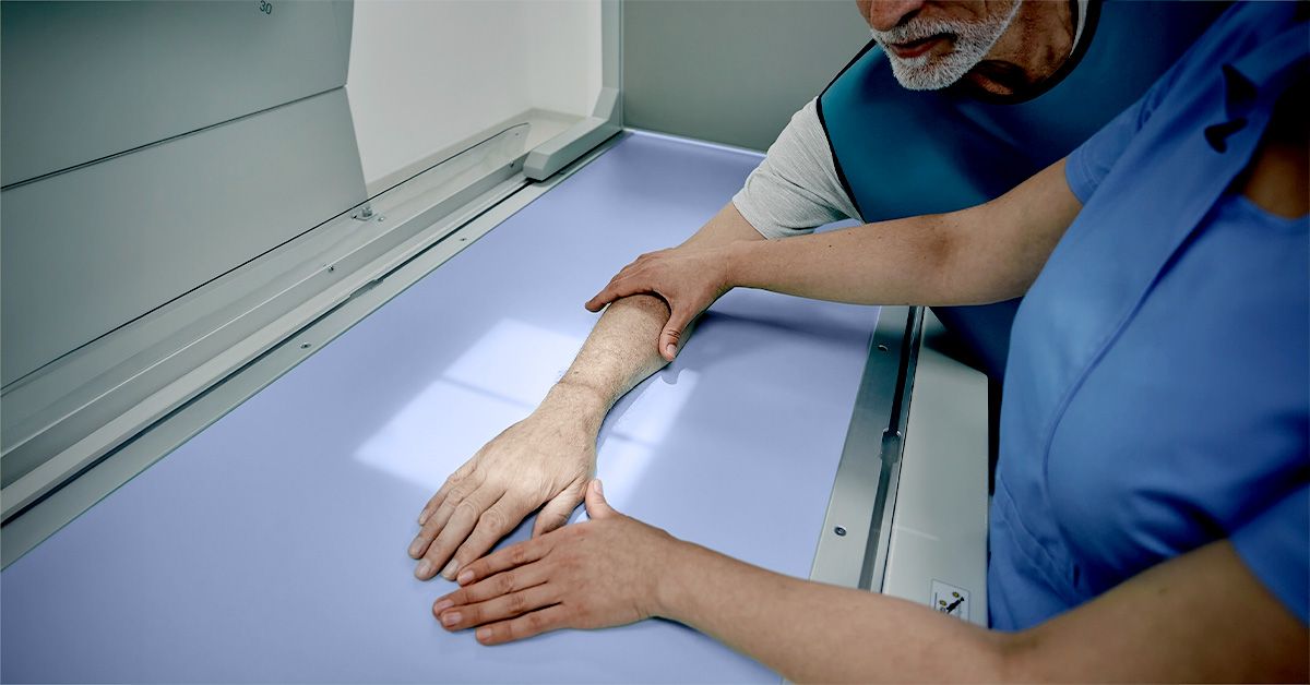 Wrist replacement: Purpose, procedure, and recovery