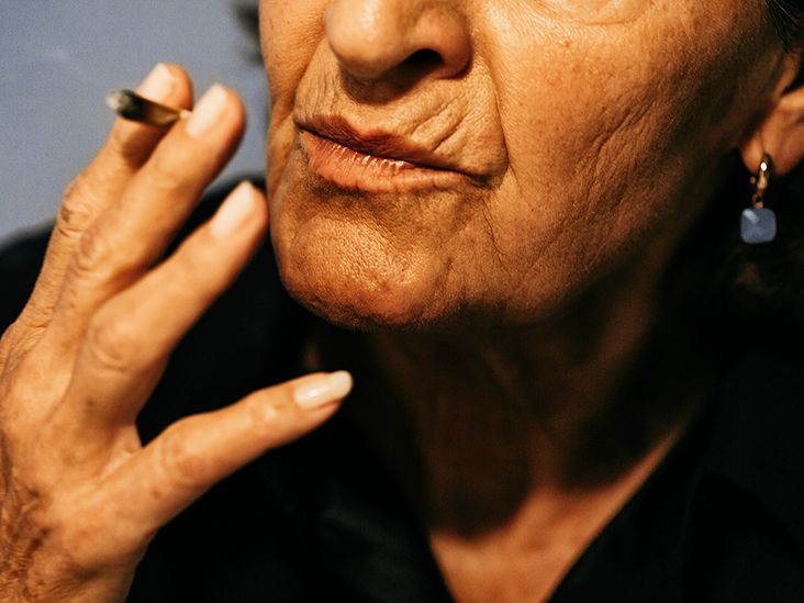 Cannabis and smoking after surgery: What to know
