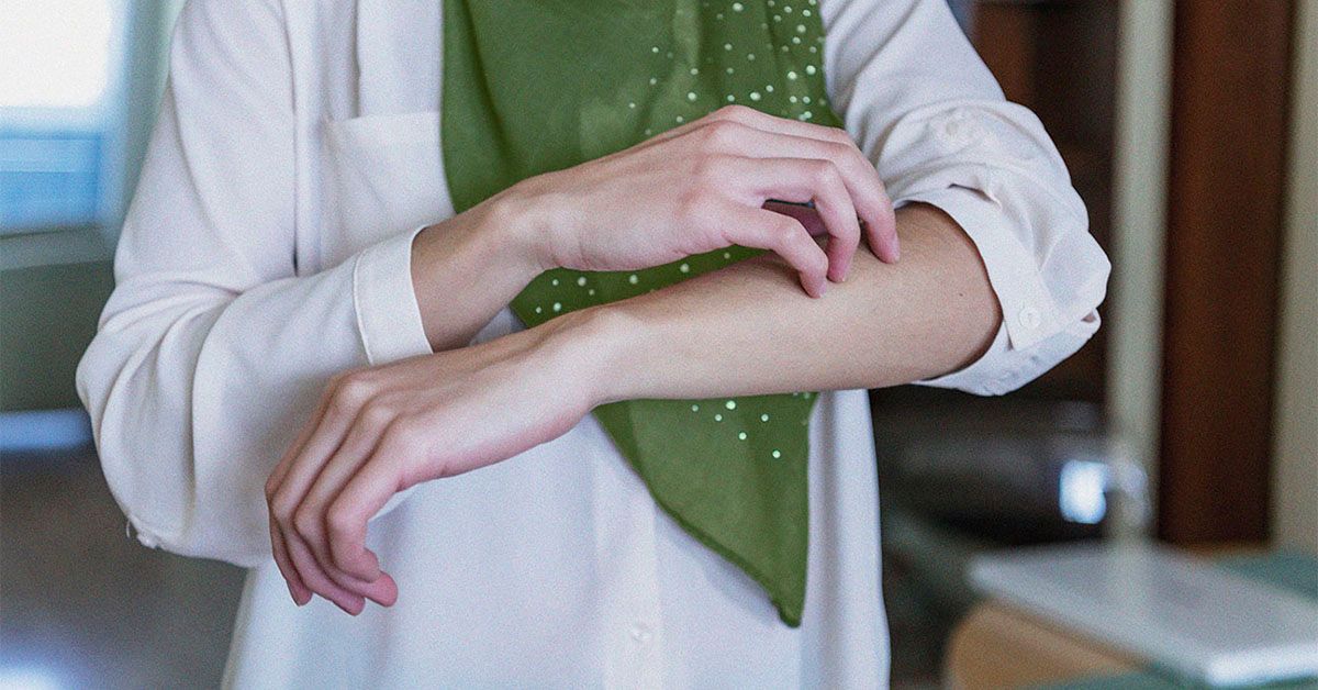 Polycythemia vera skin: What does it look like?