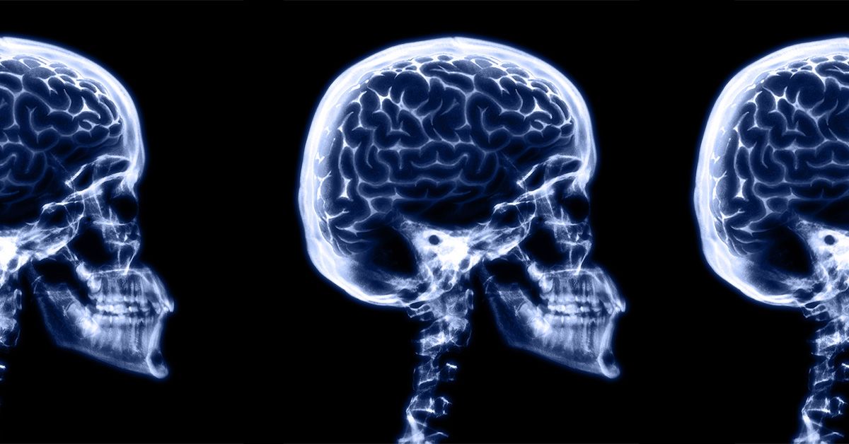 Type 1 diabetes: Glucose fluctuations may affect cognitive performance