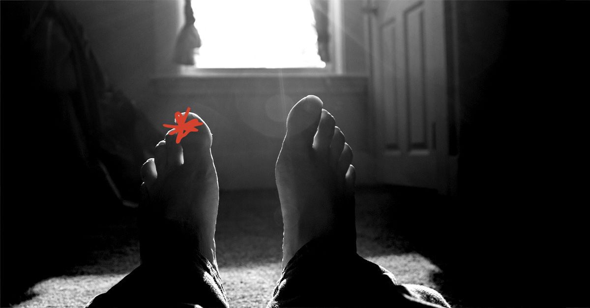 Septic arthritis pictures, symptoms, and treatment options