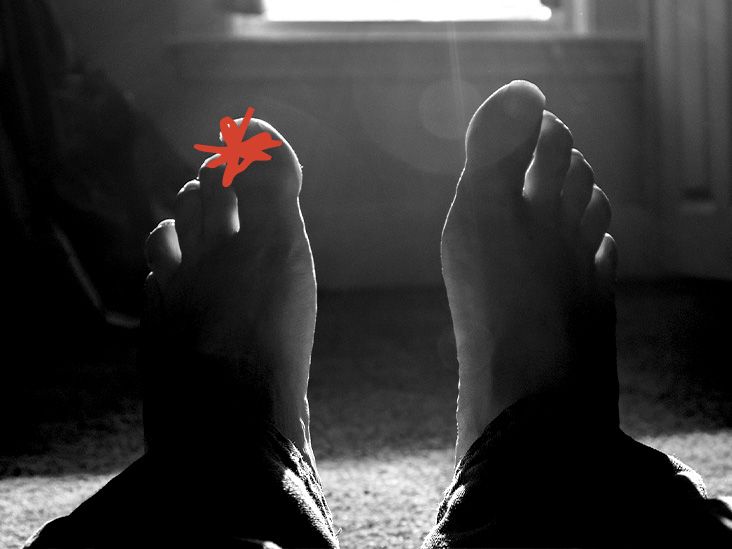 Septic arthritis pictures, symptoms, and treatment options