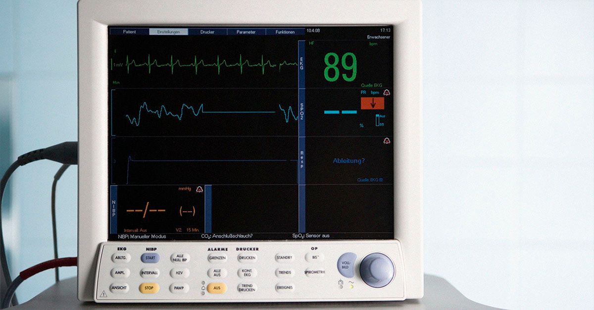 ST depression on ECG: What it means and causes