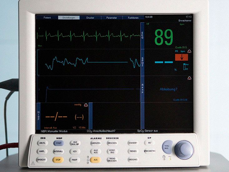 ST depression on ECG: What it means and causes