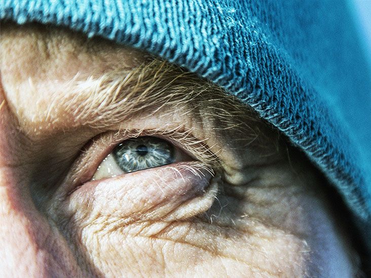 Dry eye progression: What to know