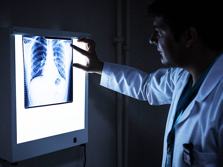 Is emphysema hereditary? Genetics, testing, and more