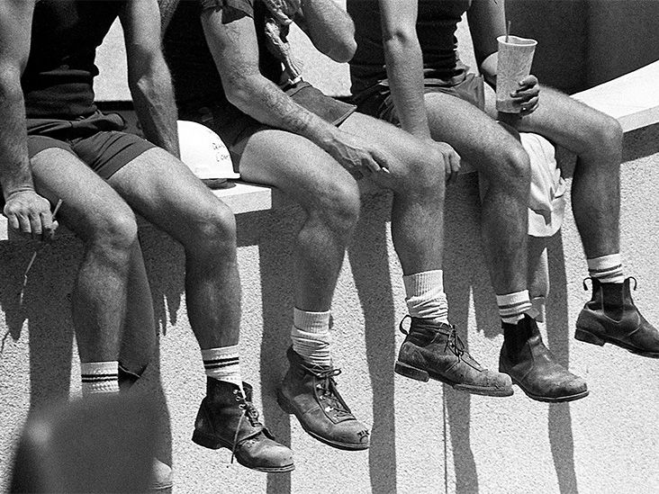 Oliguric renal failure: Phases and more