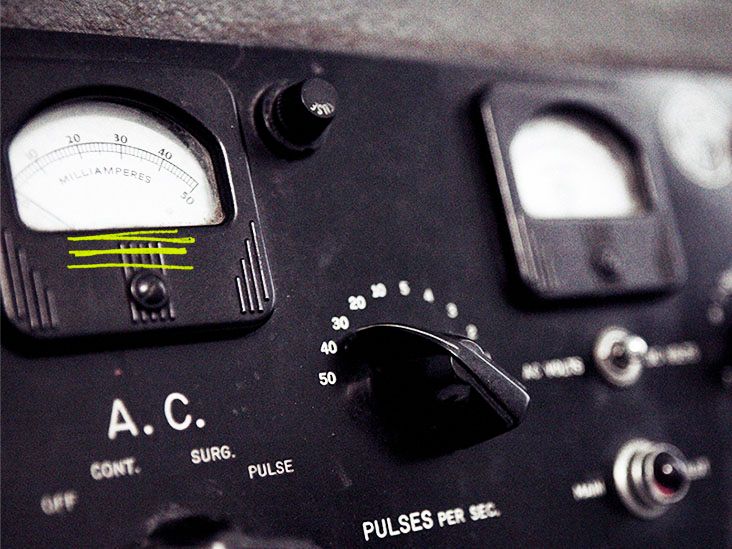 ECT for depression: Benefits, risks, and procedure