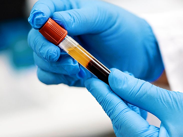 Anion gap test: Who needs one and what do the results mean?