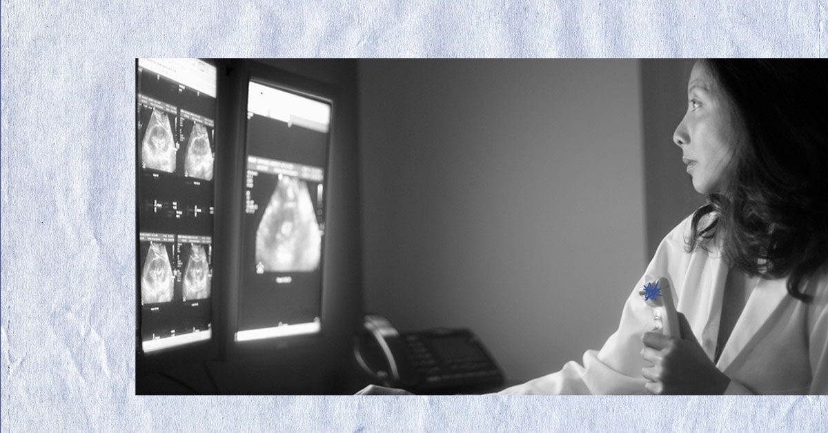 Calculous cholecystitis: Overview and more