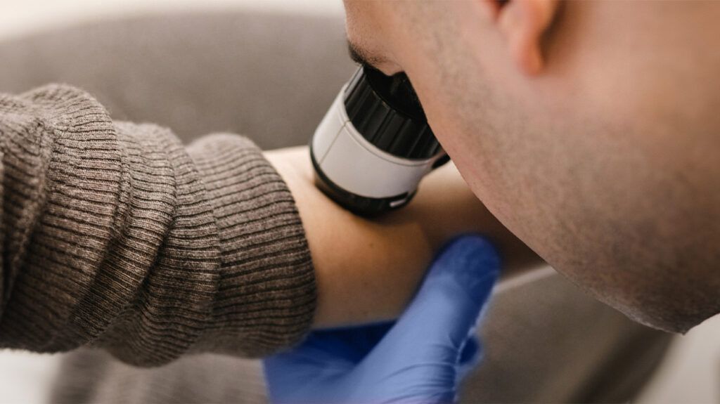 Birt-Hogg-Dubé syndrome: Symptoms, causes, and more