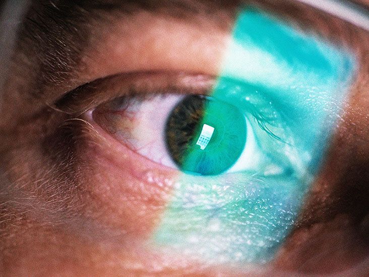 Flash Of Light In Corner Of Eye