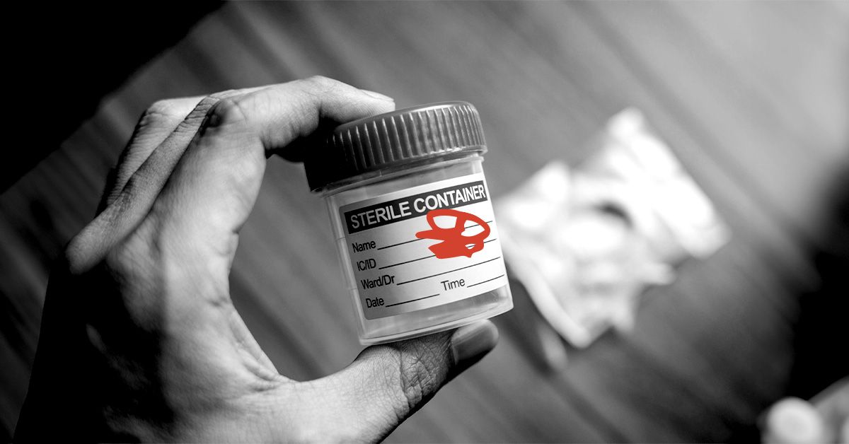 How to collect stool sample at home: Tips and more