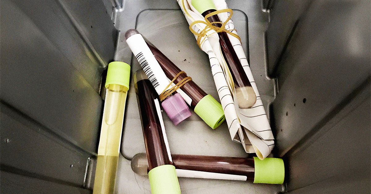 Hypocholesterolemia: Definition, symptoms, treatments, FAQ