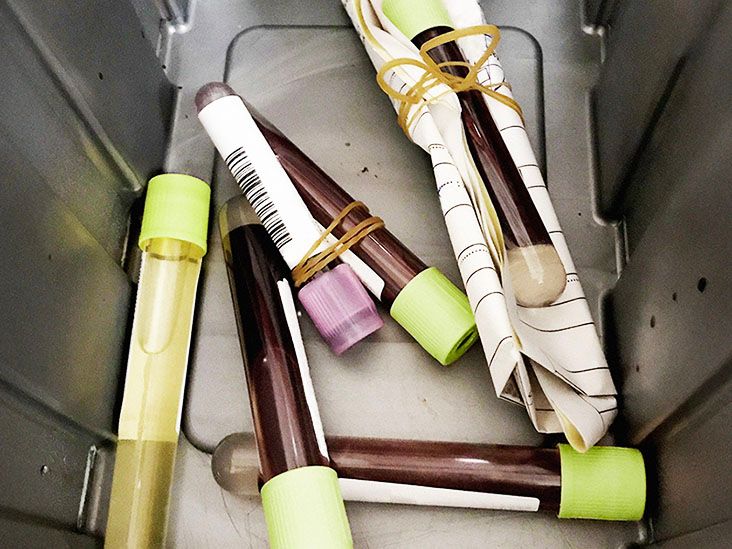 Hypocholesterolemia: Definition, symptoms, treatments, FAQ