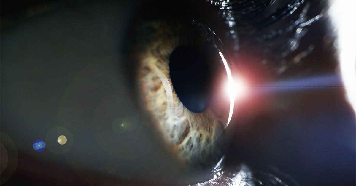 What can someone expect after laser surgery for a retinal tear?