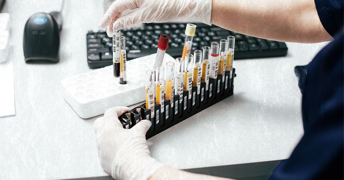 HIV viral load chart