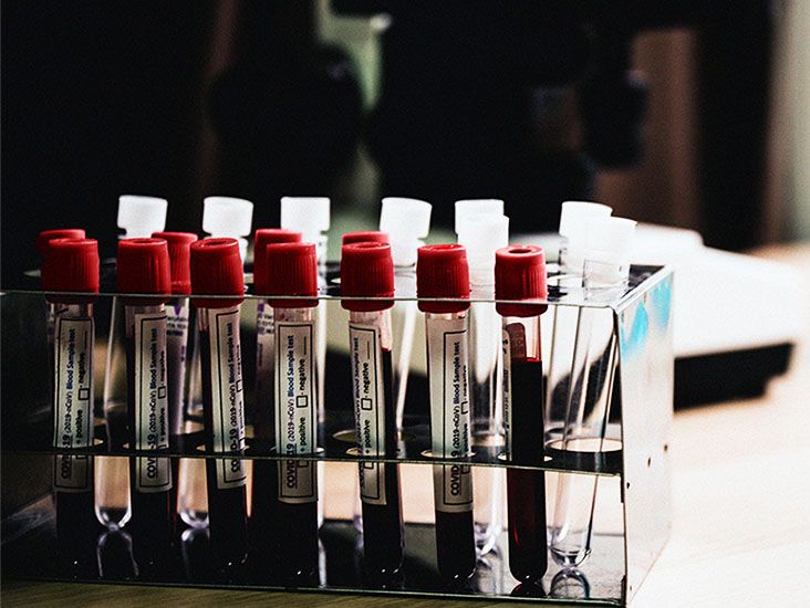 FSH Levels: Normal, high, and low ranges