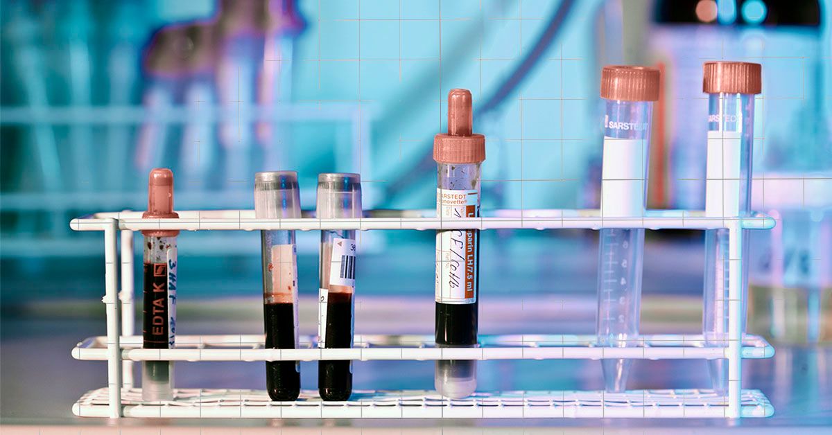 CLL flow cytometry: How it works, diagnosis, and more