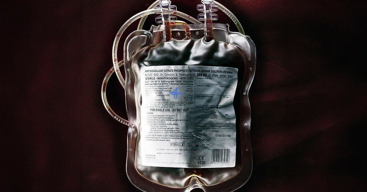 Acute blood loss anemia: Causes, symptoms, treatments