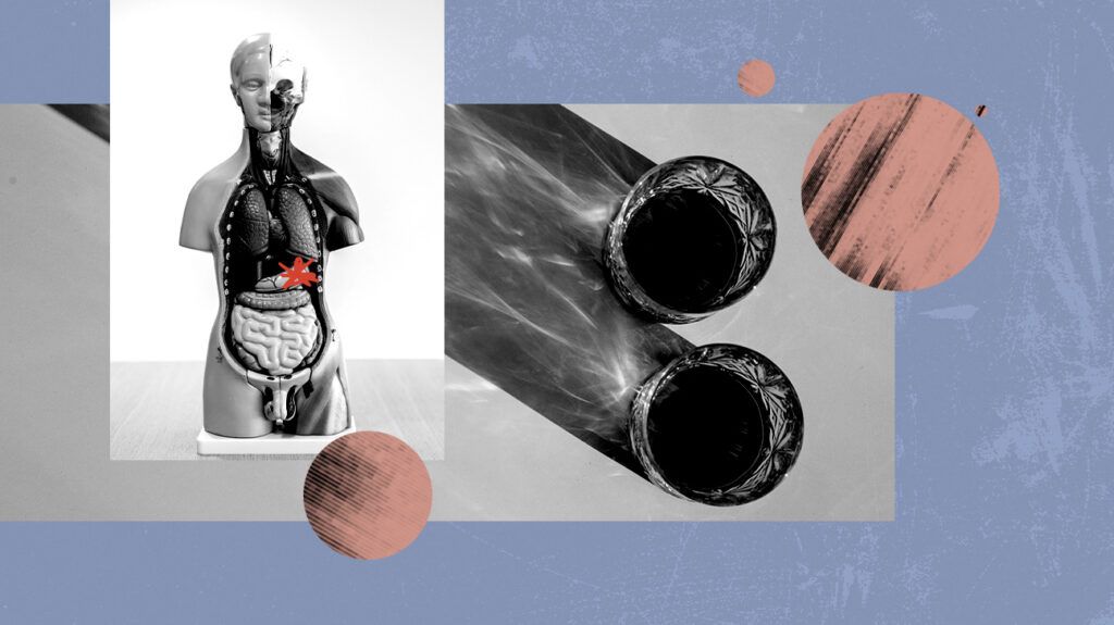 Complications of alcoholism: The effects on the body's systems