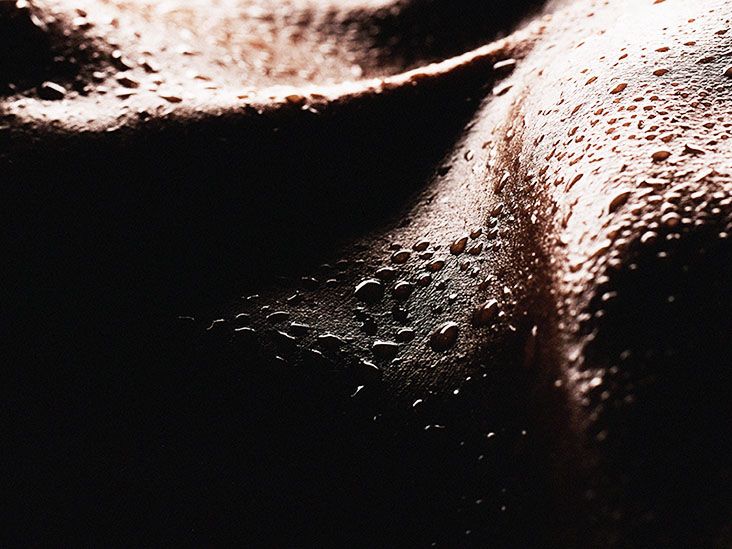 Melanoma in situ: Diagnosis, treatment, and outlook