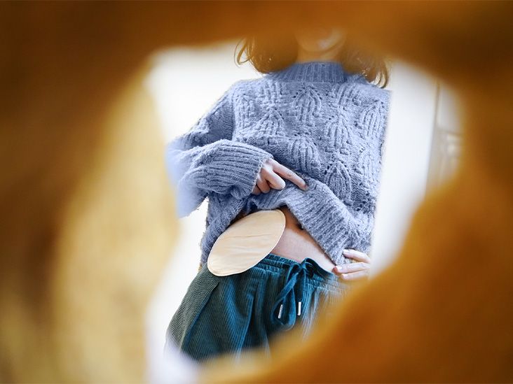 How to care for ileostomy: Tips on cleaning, skin care, and more