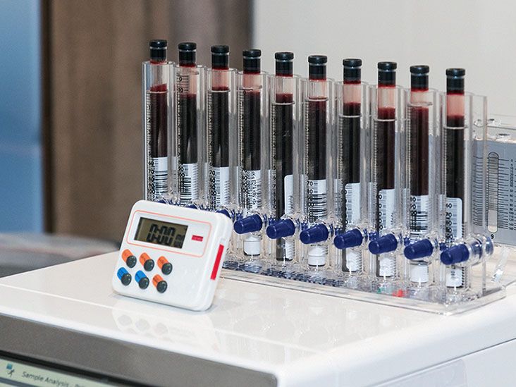 Cortisol test: What it is, purpose, and results