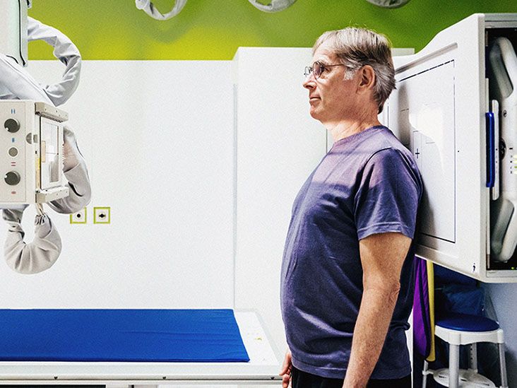 Medicare and X-rays: Coverage, costs, and more