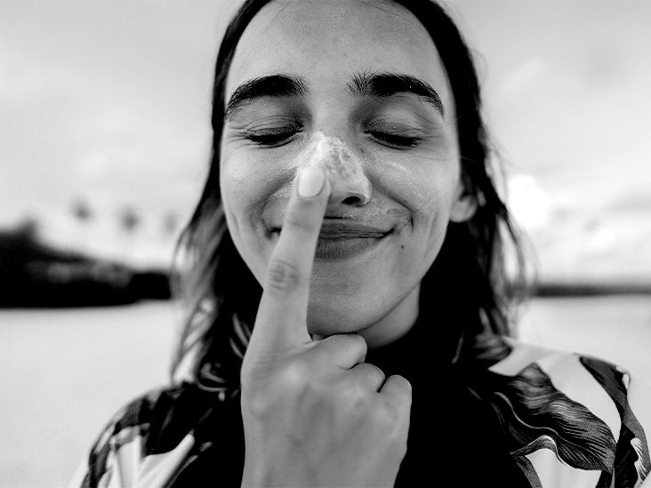 Peeling hands: Causes, treatments, and more