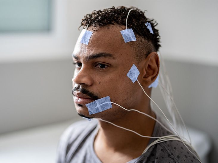 Brain stimulation therapy: Purpose, types, and side effects