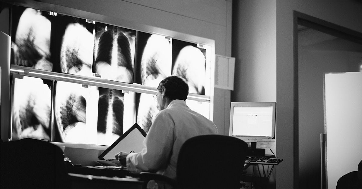 How do X-rays help diagnose bronchitis?